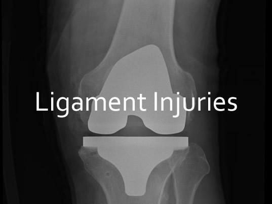 Ligament Damage
